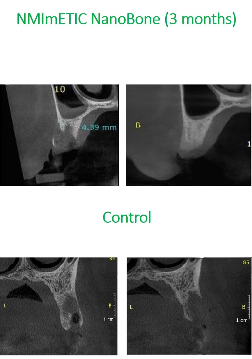 NMImETIC Products - TBMT